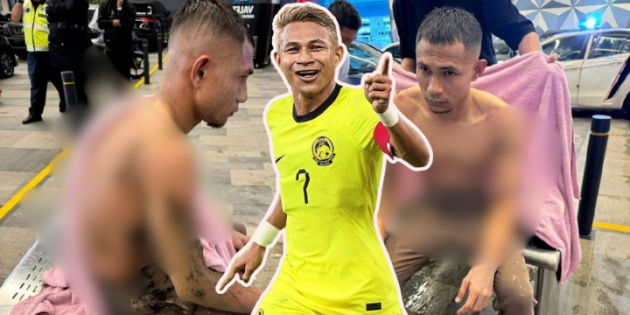 Individu Kongsi Pengalaman Terkena Asid – ‘Bisa Masih Rasa Walau Dah ...